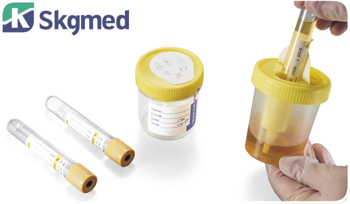 90/120ml Urine Transfer Device and Urine Tube - Buy Urine Transfer ...